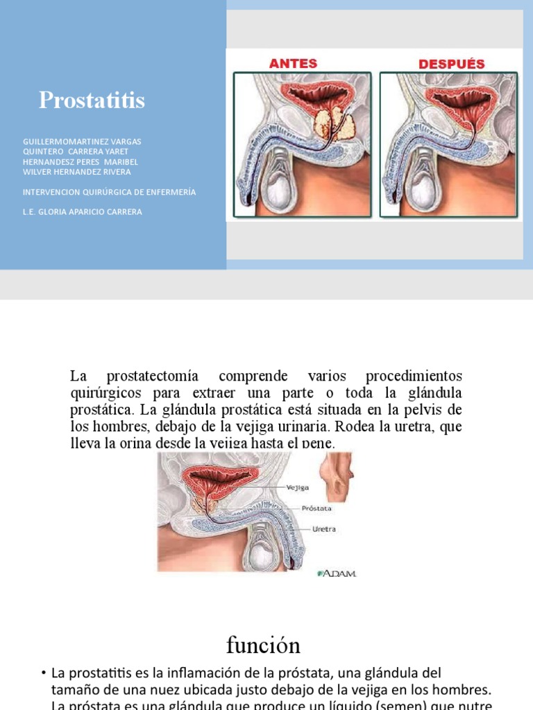 Prostatitis | PDF | Cancer de prostata | Vejiga urinaria