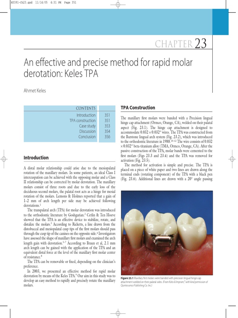 Keles TPA-An Effective and Precise Method For Rapid Molar | PDF | Tooth ...