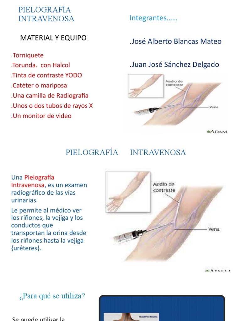 Pielografía Intravenosa 2 | PDF | Vejiga urinaria | Terapia intravenosa