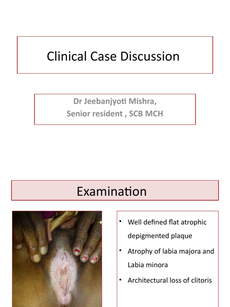 Clinical Case Discussion | PDF