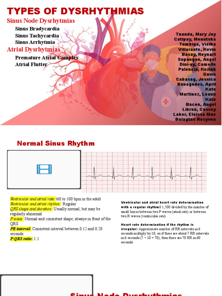 Types Of Dysrhythmias Pdf Heart Rate Heart