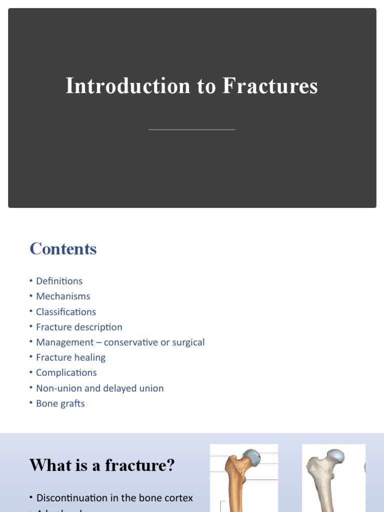 Introduction To Fractures | Download Free PDF | Bone | Medical Specialties