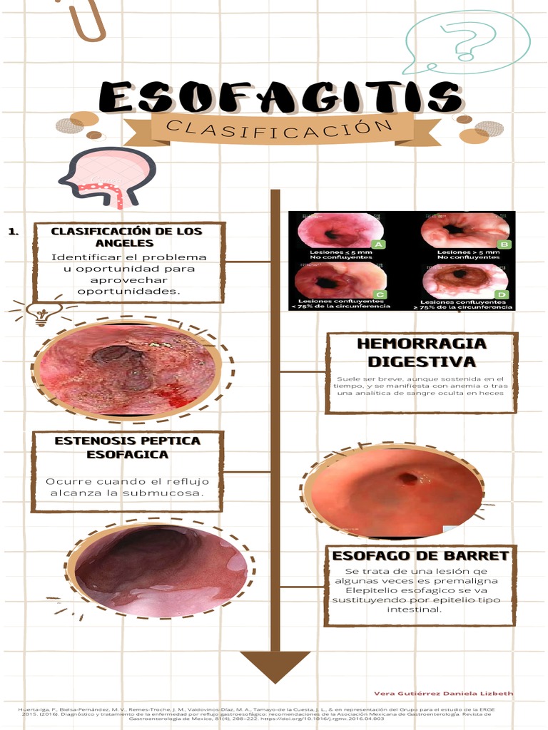 2) Clasificacion Esofagitis | PDF | La enfermedad por reflujo ...