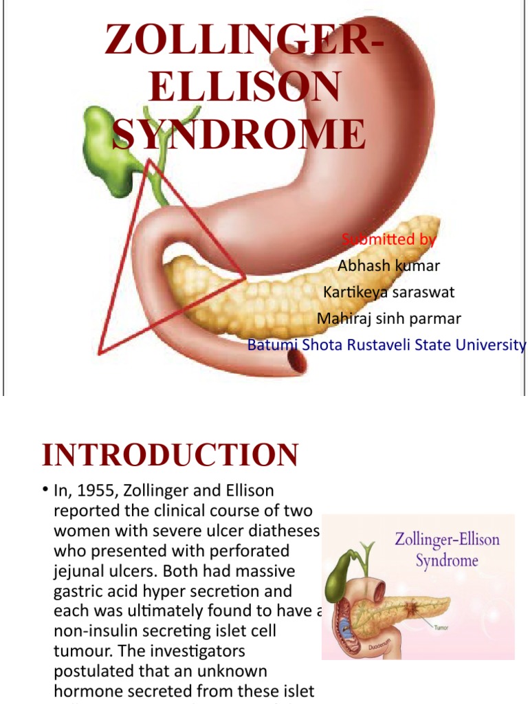 Zollinger Ellis Wps Office | PDF | Anatomy | Abdomen