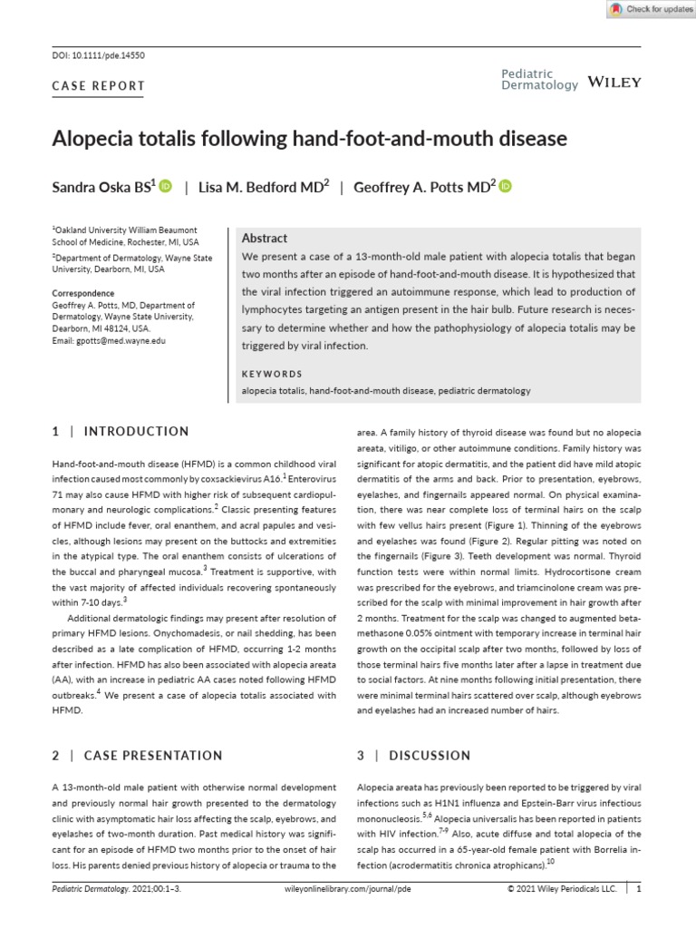 Alopecia Totalis Following HFMD | PDF | T Helper Cell | T Cell