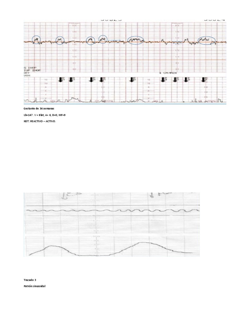 Práctica NST para Compartir 4 | PDF
