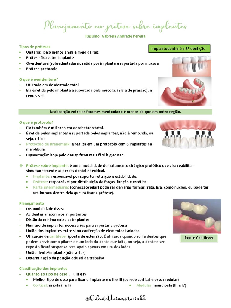 Planejamento em Prótese Sobre Implantes | PDF | Prótese | Dente