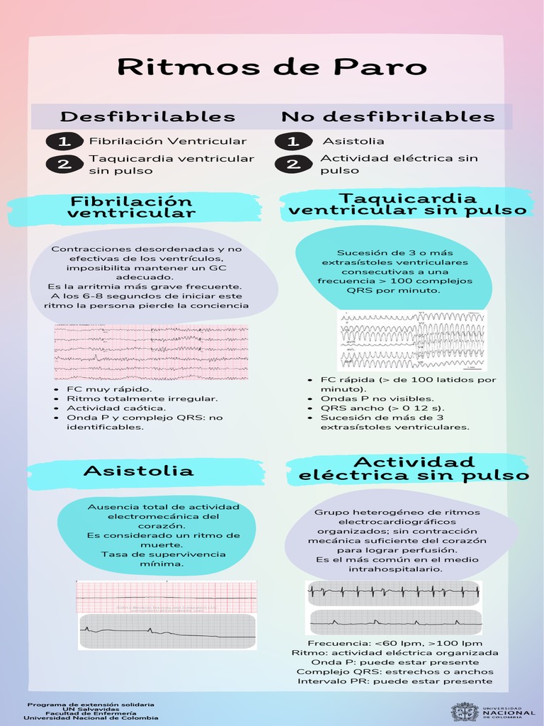 Ritmos de Paro | PDF | Electrocardiografia | Enfermedades cardiovasculares
