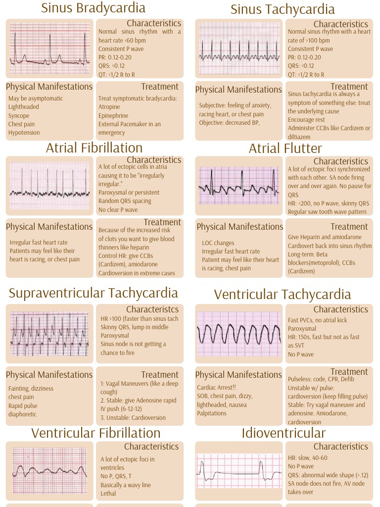 ECG Rhythm Interpretation Guide | PDF | Heart | Heart Rate
