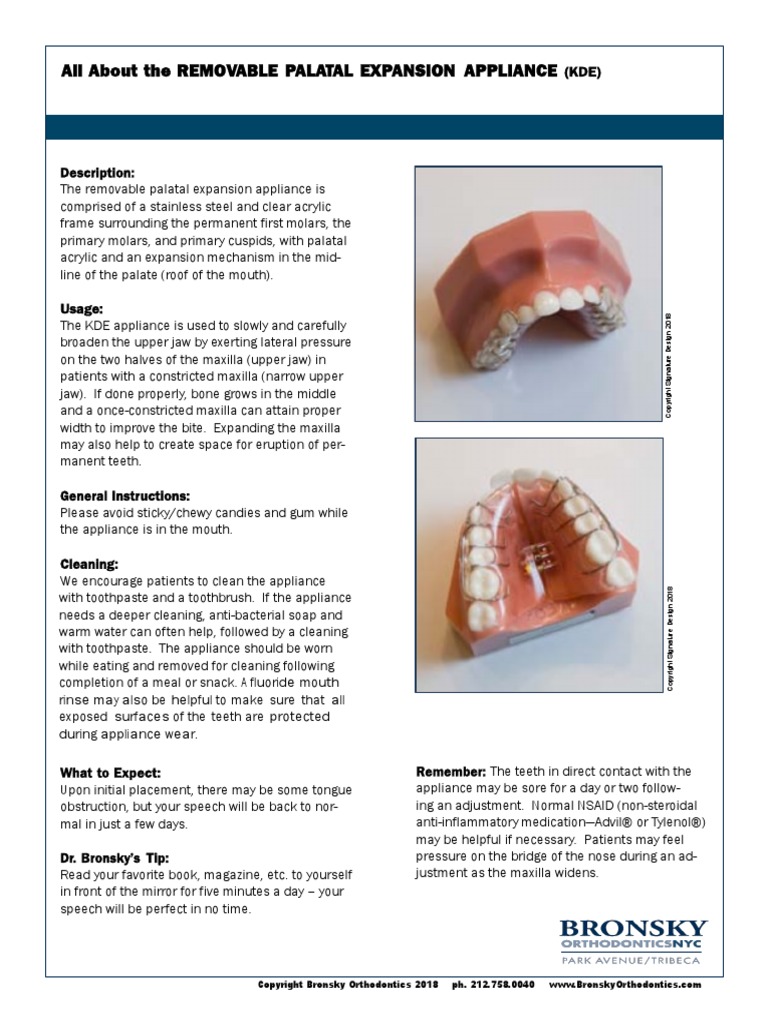 All About The REMOVABLE PALATAL EXPANSION APPLIANCE KDE | PDF ...