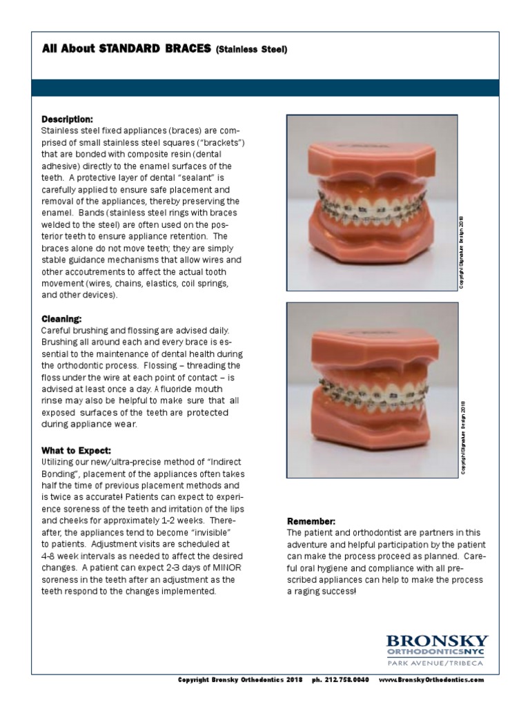 All About STANDARD BRACES Stainless Steel | PDF | Orthodontics | Oral ...