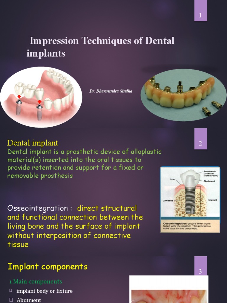 Dental Implant Impression Techniques | PDF | Dental Implant | Computer ...