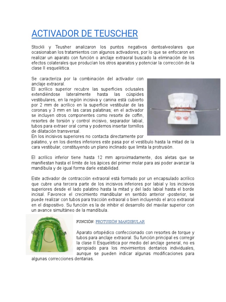 El activador de Teuscher: un aparato ortopédico con anclaje extraoral ...