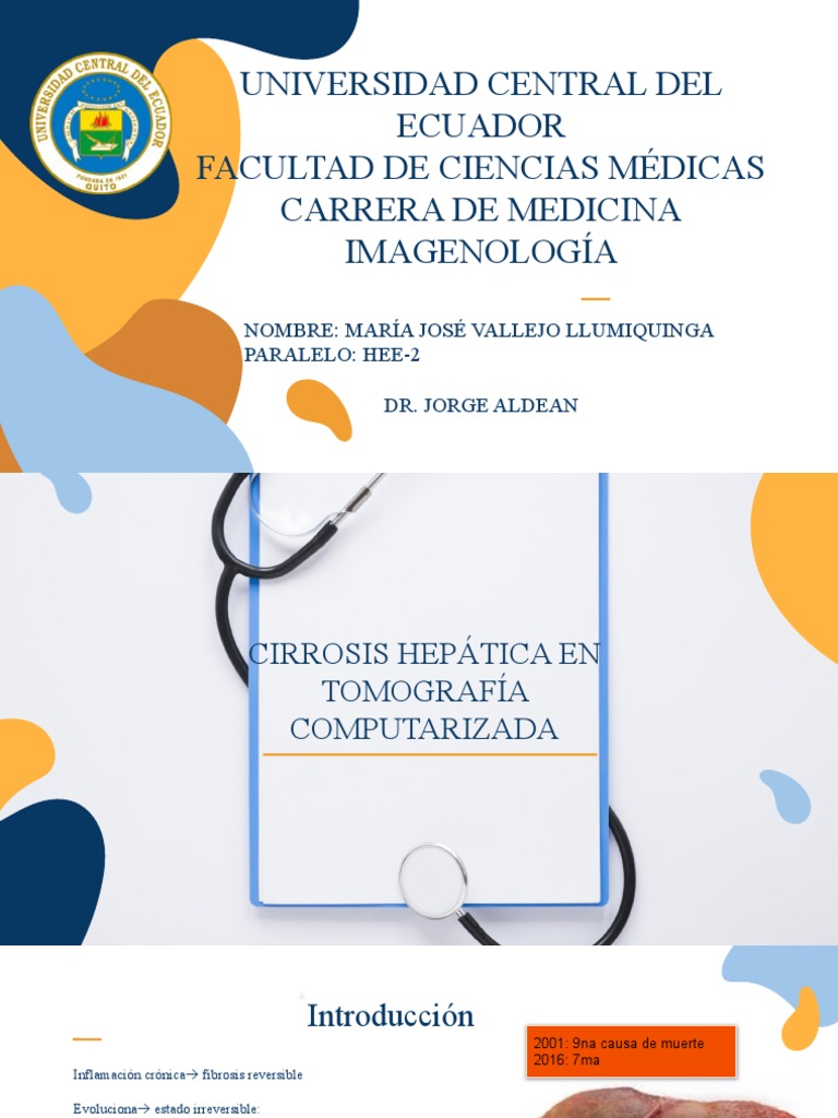 Cirrosis Hepática | PDF | Cirrosis | Hígado