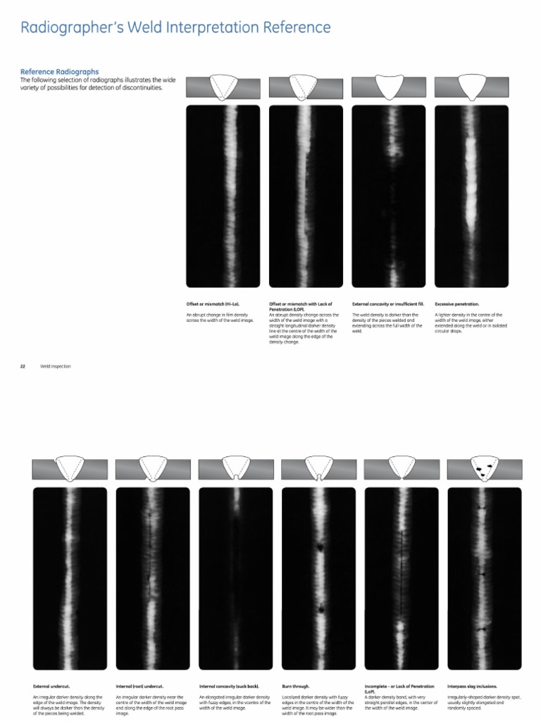 Reference Radiographs | PDF