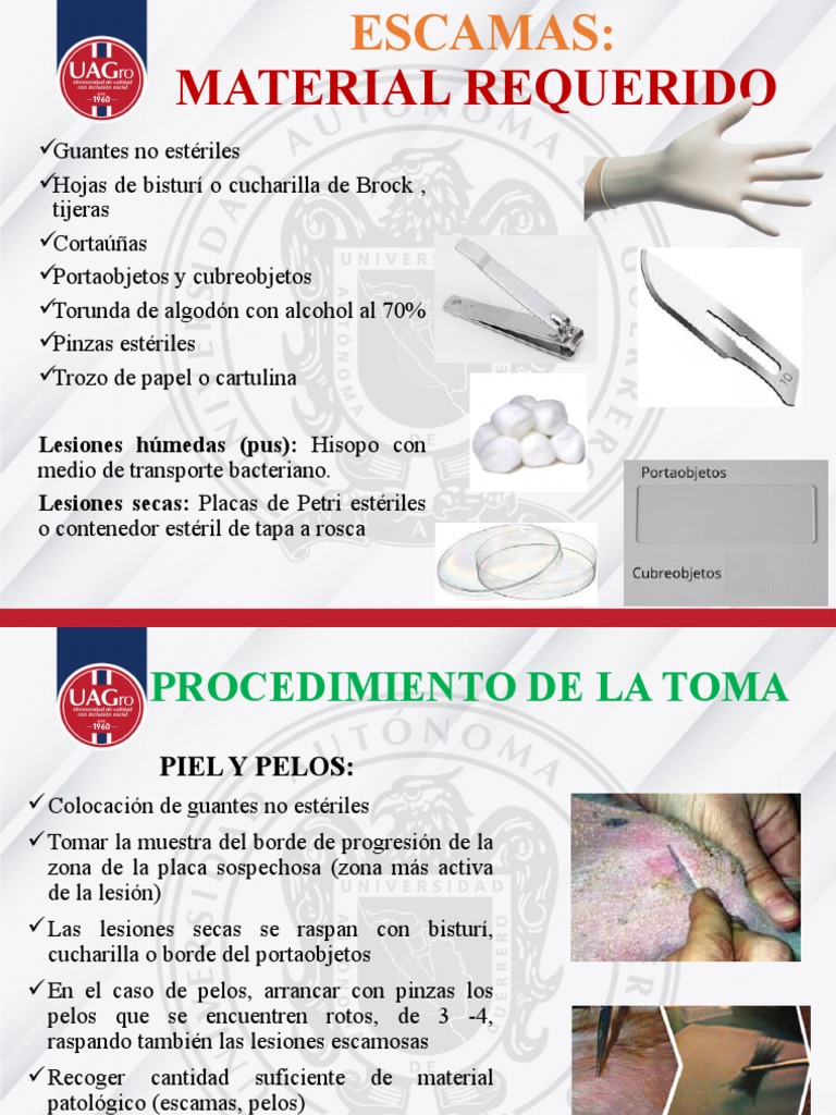 Escamas y Secreciones - Material y Procedimiento | PDF | Clavo ...