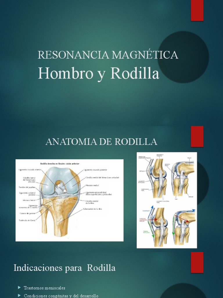 Presentacion Rodilla | PDF | Rodilla | Sistema musculoesquelético