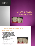 GV Black's Cavity Classification Guide | PDF | Tooth Enamel | Dentistry ...