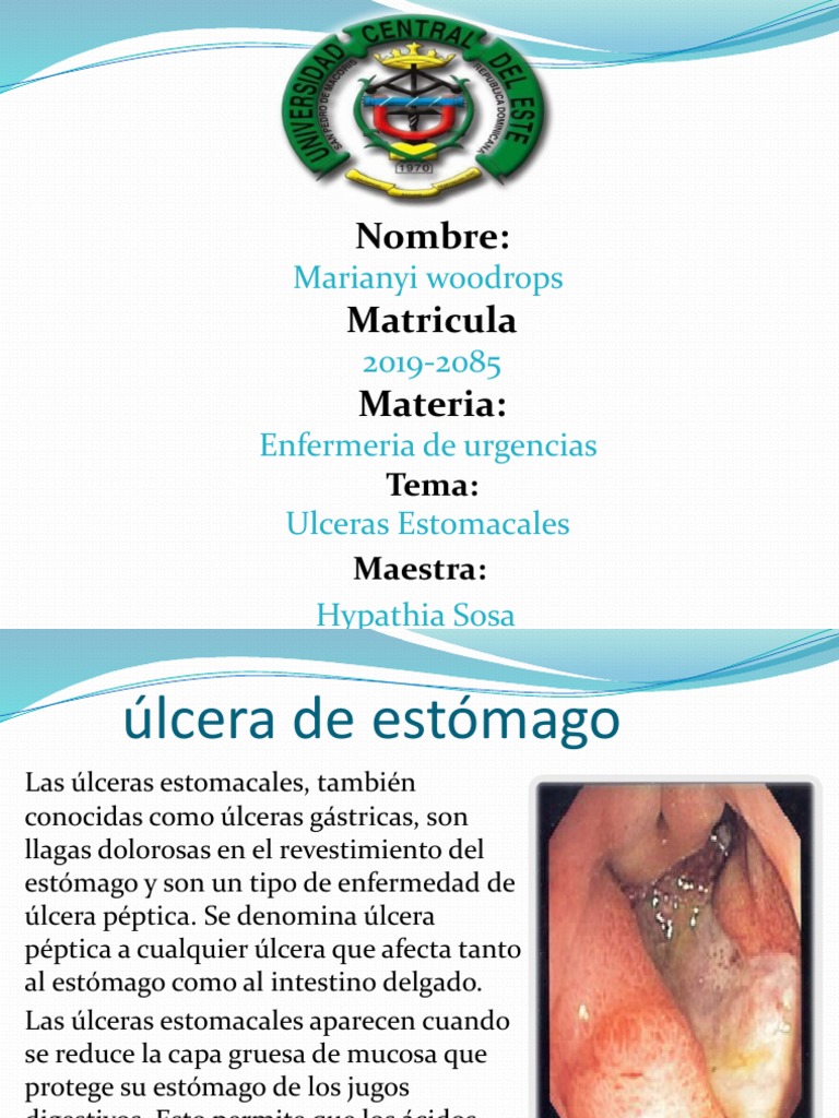 Ulceras Estomacales | PDF | Salud y bienestar