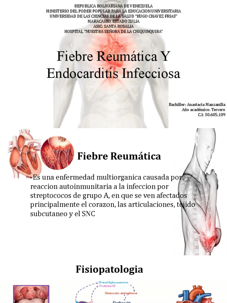 Fiebre Reumatica y Endocarditis Infecciosa | PDF