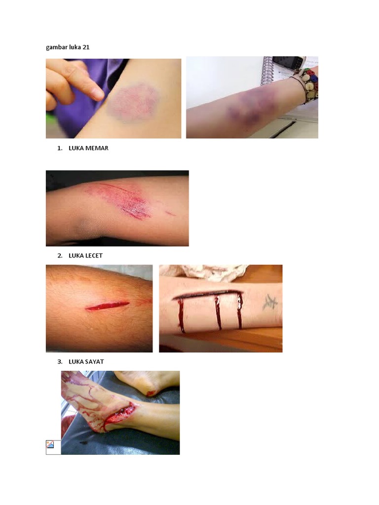 Gambar Luka 21 | PDF