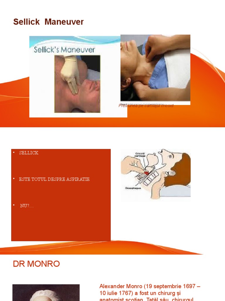 Sellick Maneuver | PDF