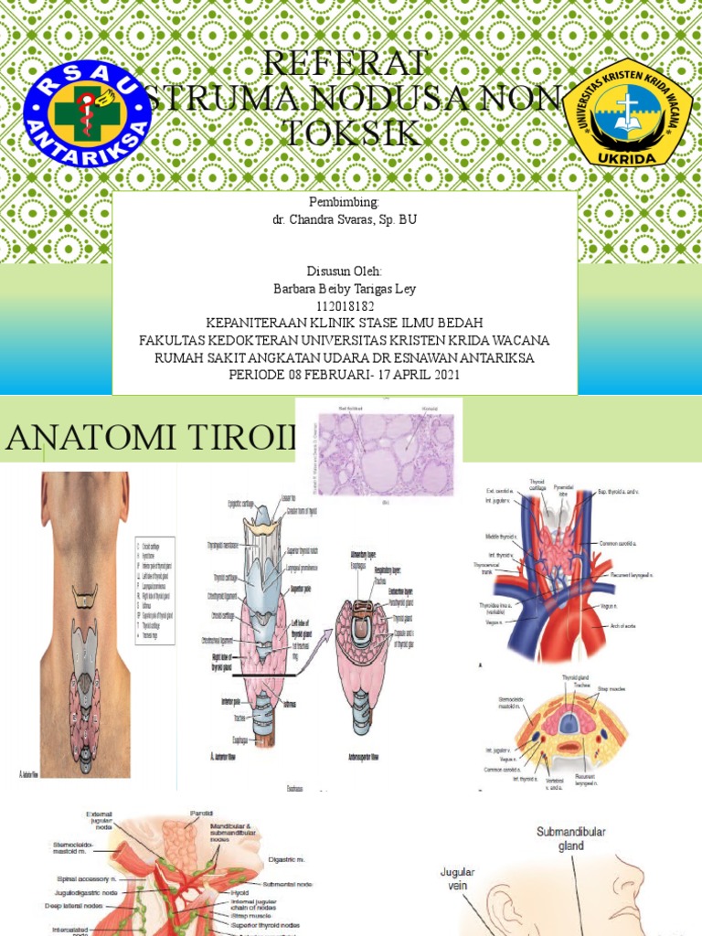 Referat Struma Nodusa Non Toksik | PDF