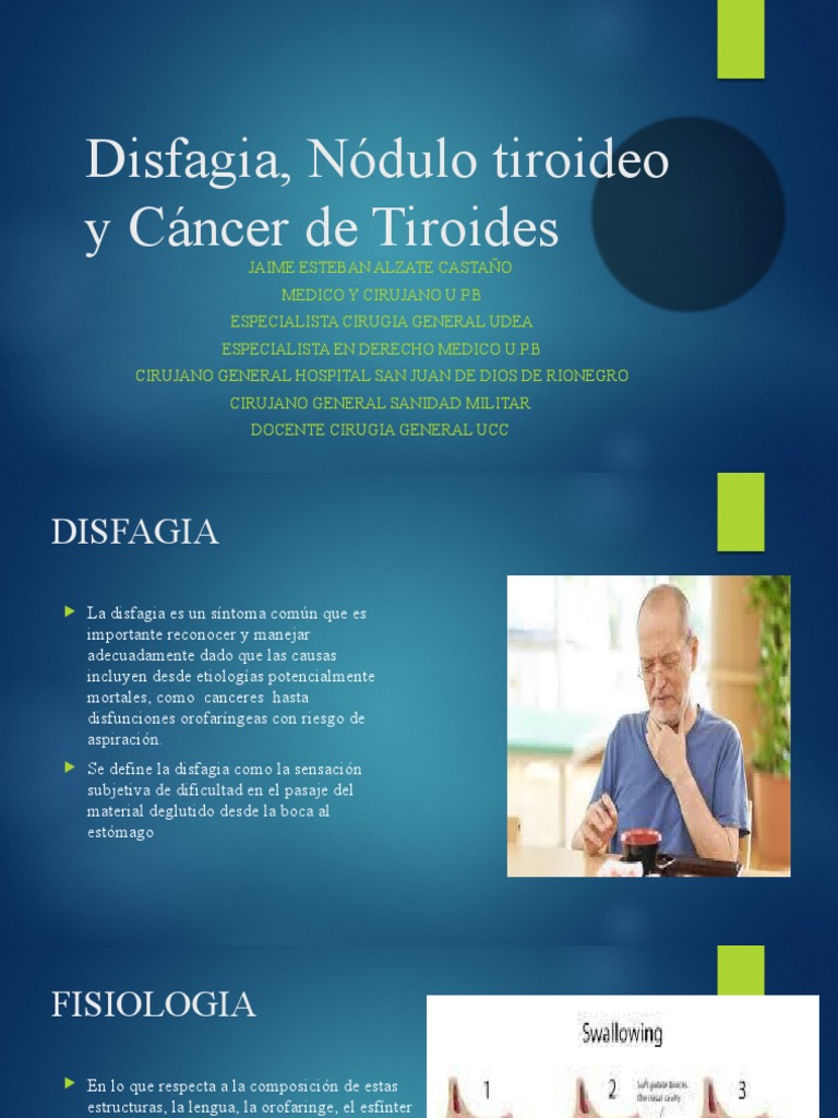 Clase Disfagia, Nodulo Tiroideo y Cancer de Tiroides | PDF | Esófago ... Clase Disfagia, Nodulo Tiroideo y Cancer de Tiroides | PDF | Esófago ...