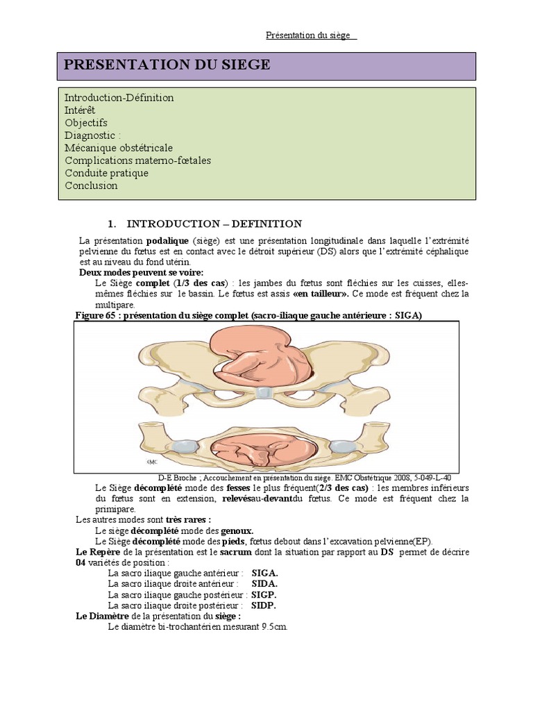 Accouchement en Présentation du Siège | PDF | Accouchement | Obstétrique