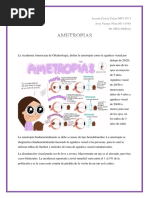Astenopia: Causas y Tratamientos | PDF | Ojo humano | Oftalmología
