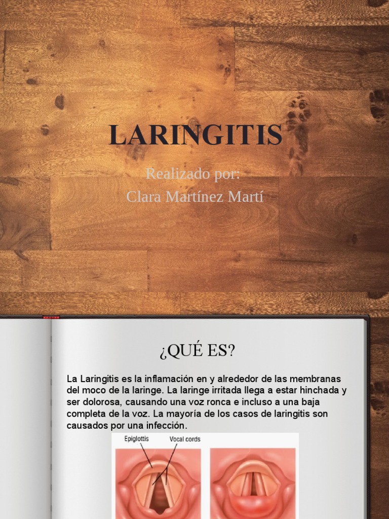 Laringitis: causas y síntomas clave | PDF | Cocina, comidas y vino