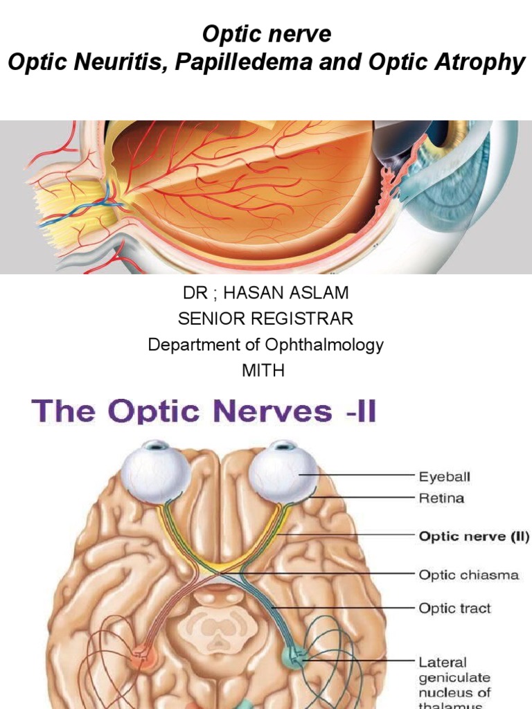 Optic Nerve Pathologies | PDF | Retina | Clinical Medicine