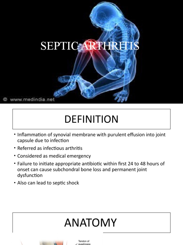Understanding Septic Arthritis | PDF | Infection | Epidemiology