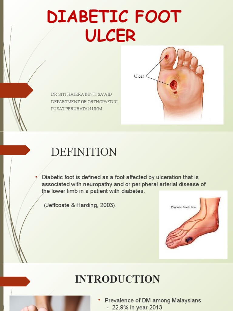 Diabetic Foot Ulcer Guide | PDF | Peripheral Neuropathy | Wound