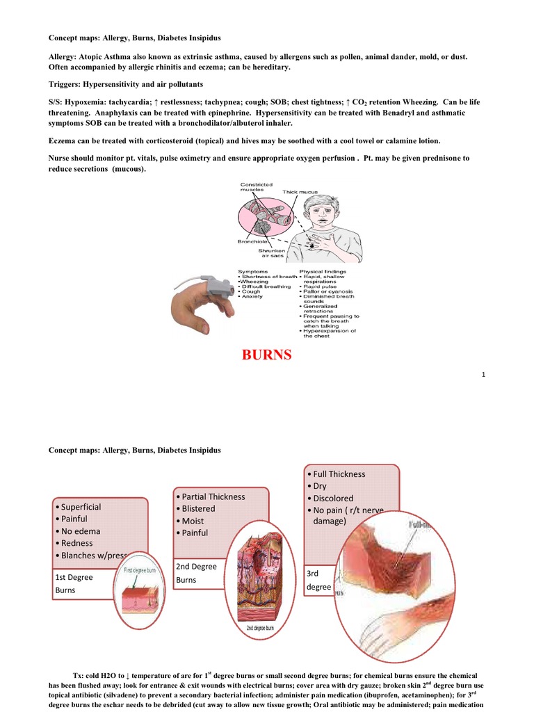 Concept Map Allergy, Burns, DI | PDF