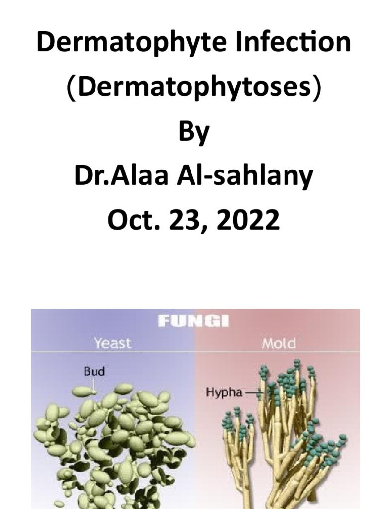 Dermatophyte Infection | PDF | Cutaneous Conditions | Microbiology