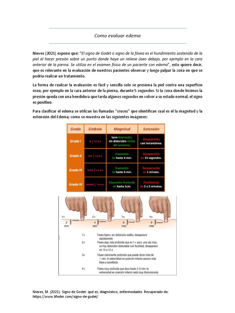 Signo de Godet y evaluación de edema | PDF