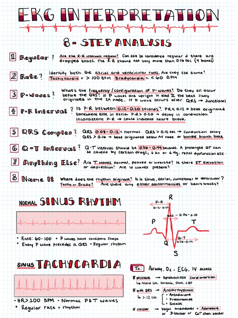 EKG Interpretation and Dysrhythmias | PDF