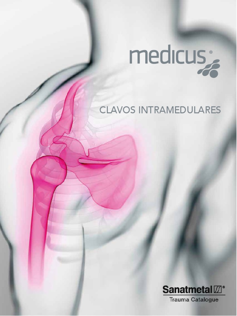 01 02 03 03 Clavos Intramedulares Medicus v1 | PDF | Anatomía | Anatomía humana