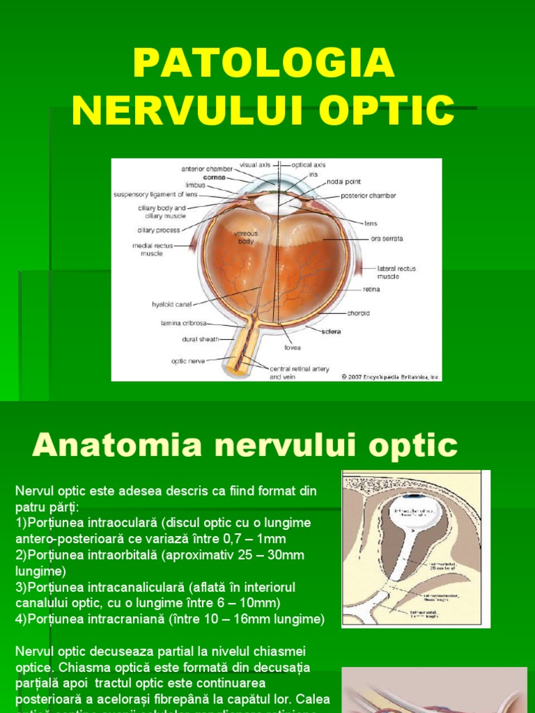 Patologia Nervului Optic | PDF