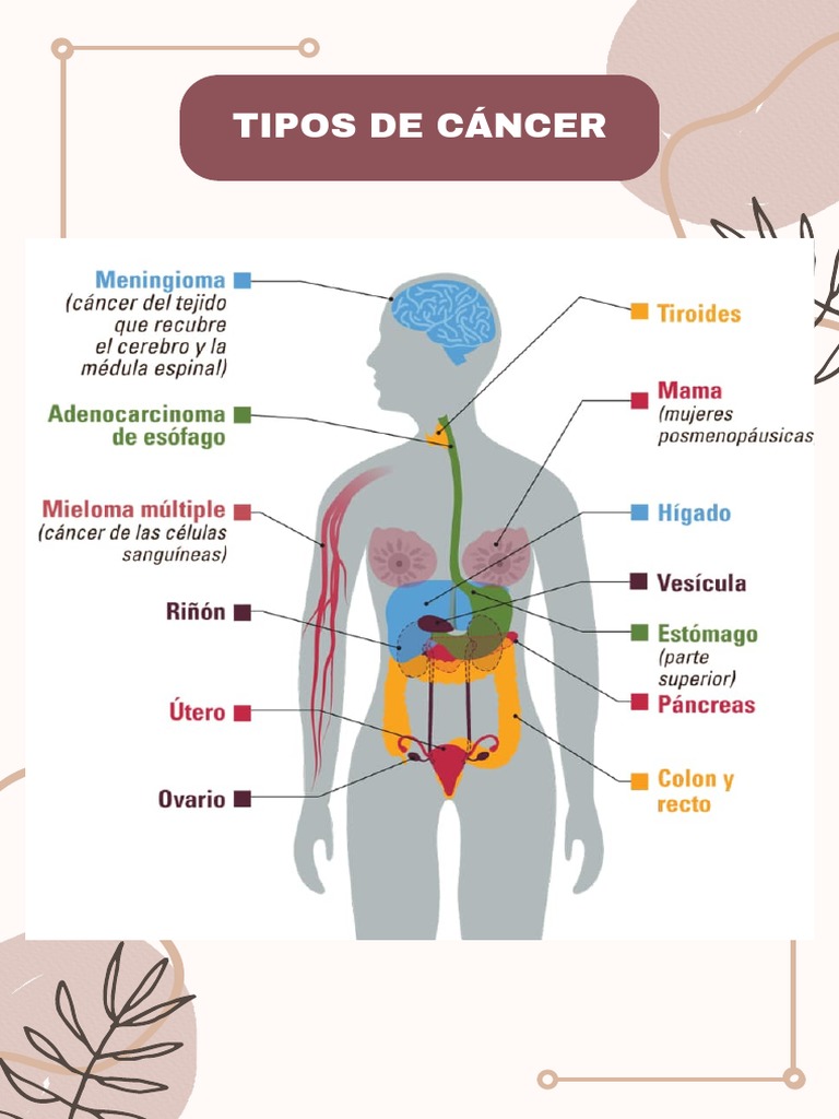 Tipos de Cáncer | PDF