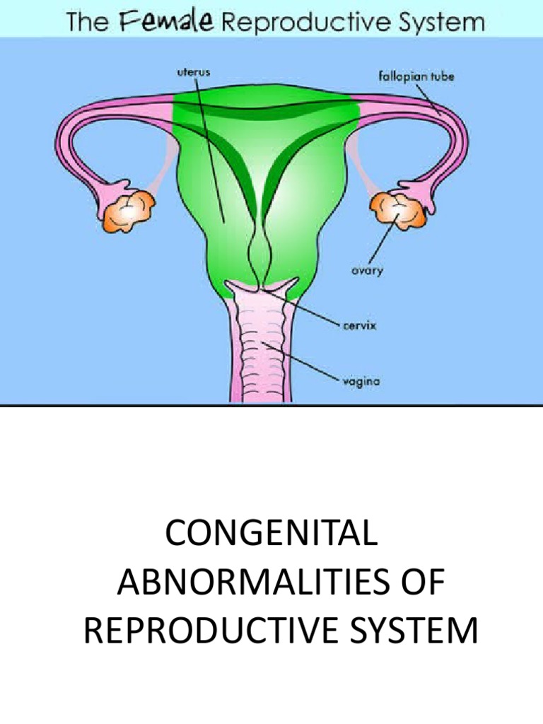Congenital Anomalies of Female Genitalia | PDF | Vagina | Uterus