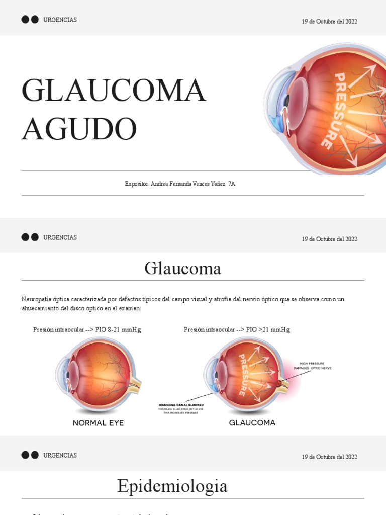 Glaucoma Agudo | PDF | Glaucoma | Sistema visual