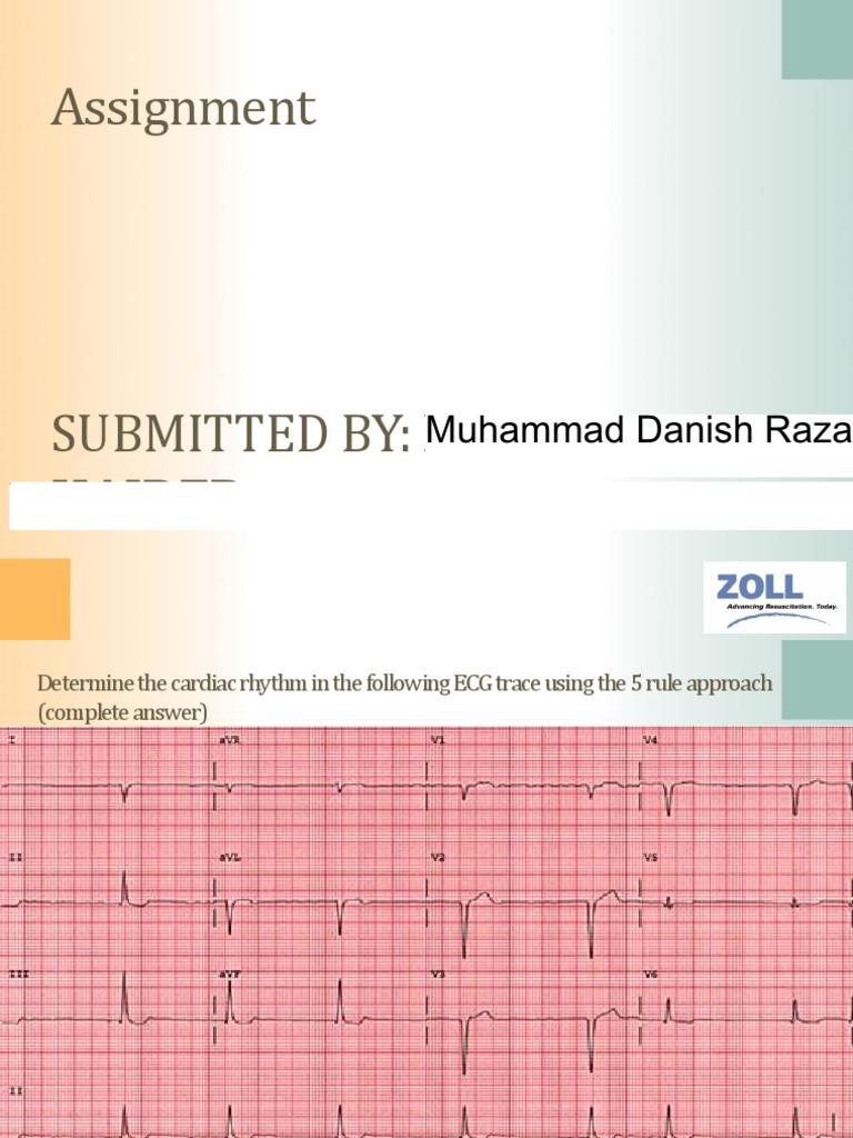 ECG Najeeb Haider | PDF