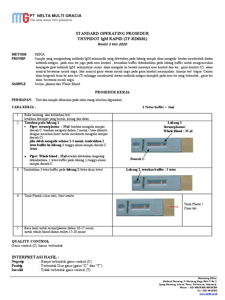 SOP TYPHIDOT IgM-rev3 | PDF
