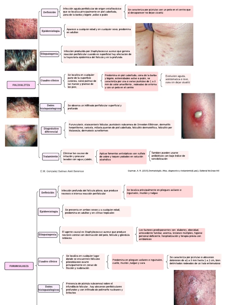 Foliculitis y Forunculosis: Diagnóstico y Tratamiento | PDF ...