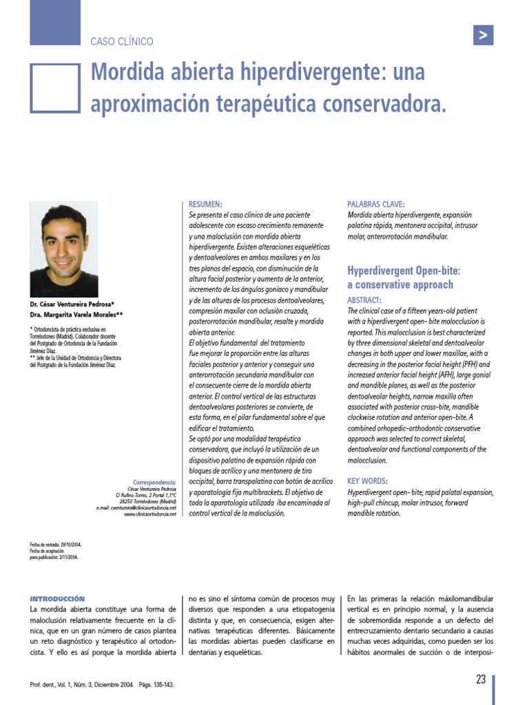 Mordida Abierta Hiperdivergente - Una Aproximaciã N ... - COEM | PDF ...