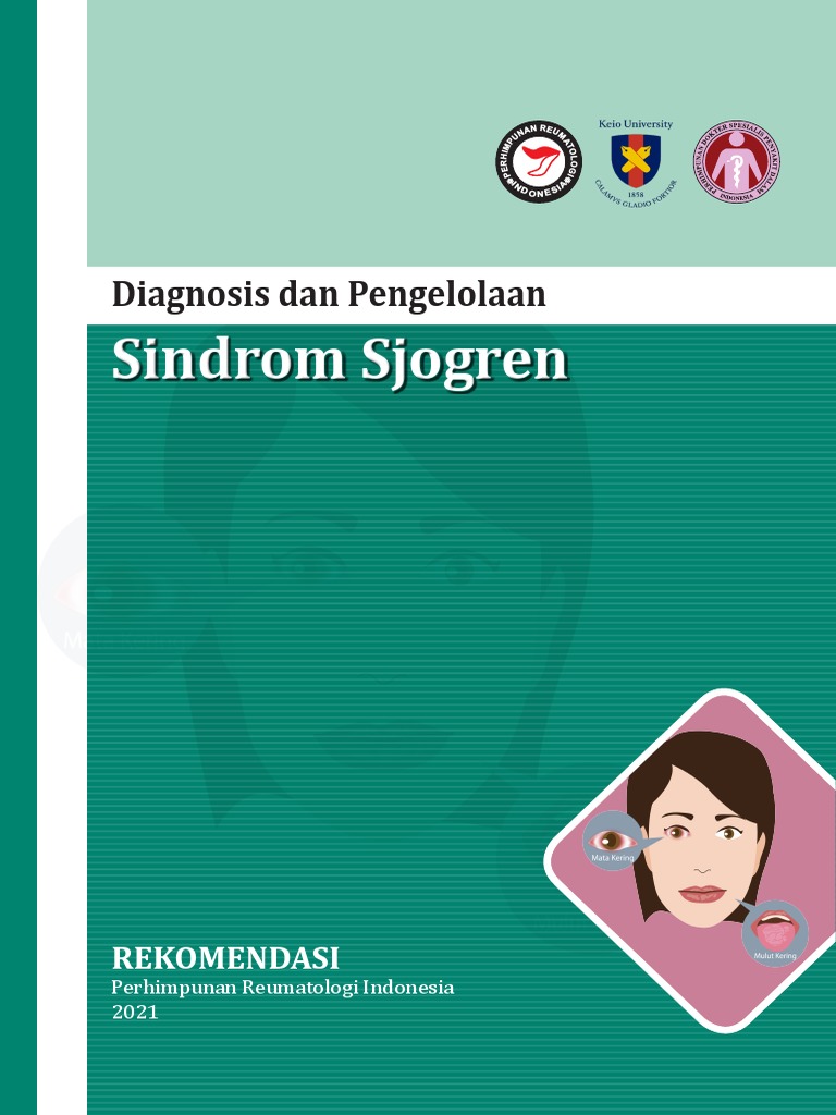 Sindrom Sjogren | PDF