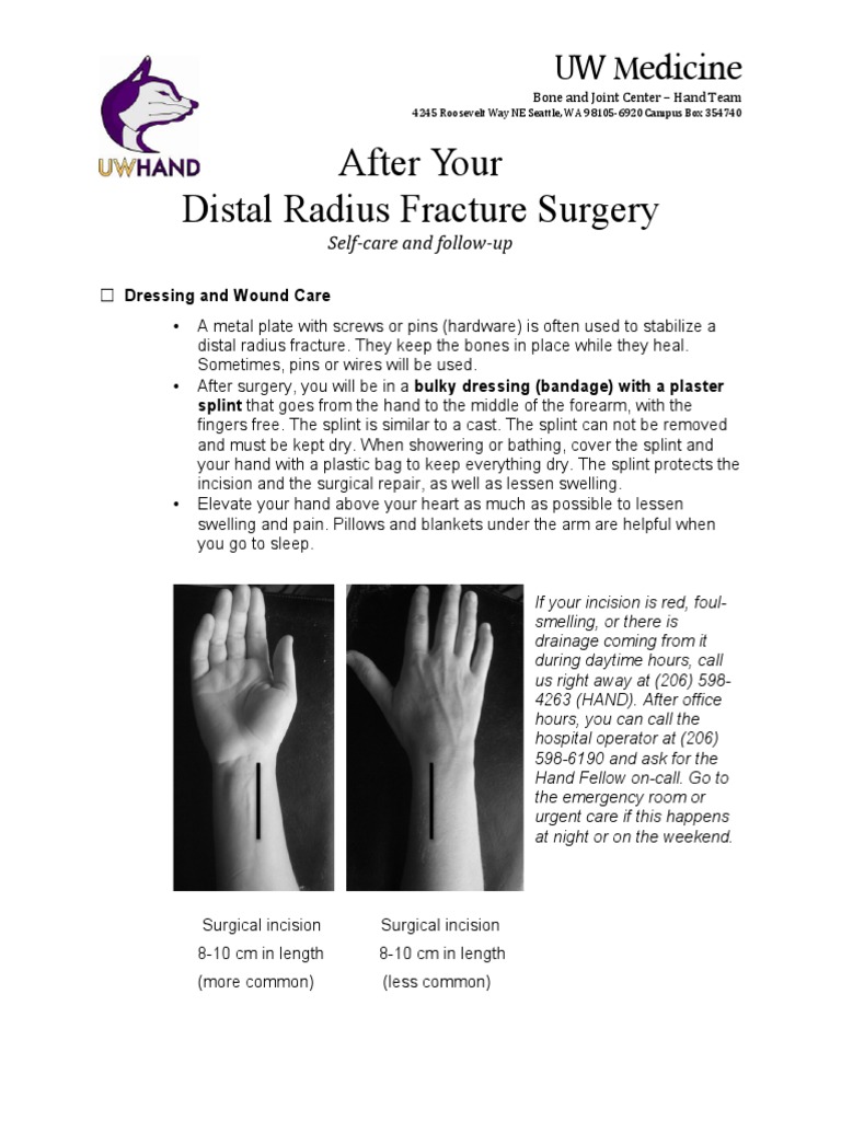 Post Surgery Distal Radius Fracture July 2013 | PDF | Hand | Surgery