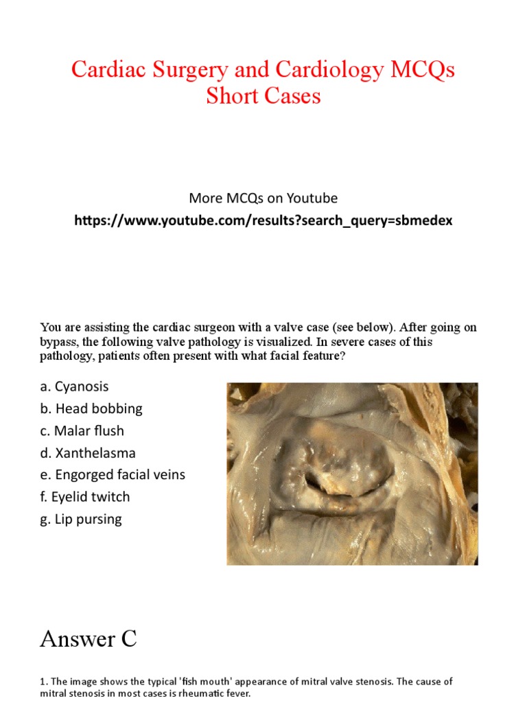 Cardiac Surgery & Cardiology MCQs | PDF | Heart | Atrium (Heart)